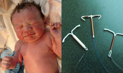 Baby boy born with Mother’s birth control device in hand! See viral ...