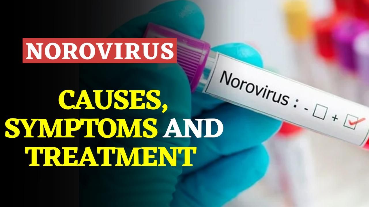 Norovirus : Latest News, Videos and Photos on Norovirus - India.Com News